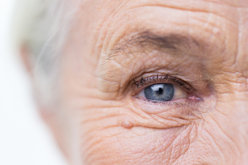 Busting The Common Wrinkle Myths In Seniors | Seaton Senior Living